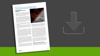 pco.edge 4.2 LT USB sCMOS Camera | Excelitas